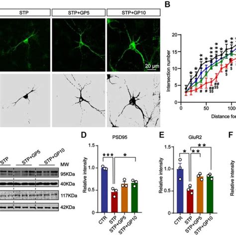 Effects Of Gp On Neuronal Dendrites And Synaptic Plasticity Related