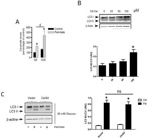 Role Of Sphingosine Kinase 1 In Glucolipotoxicity Induced Early