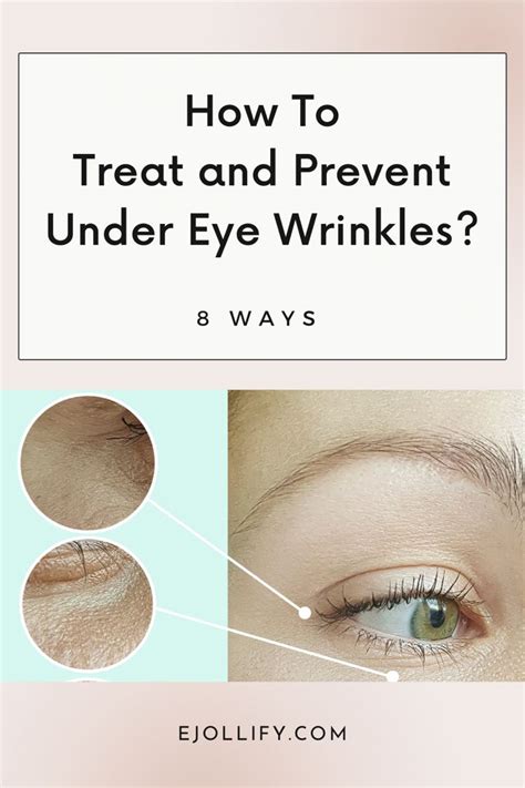 Under Eye Creases Artofit