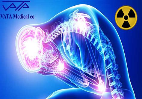 X Ray Radiation Effects On Human Body Vata Medical Engineering Company