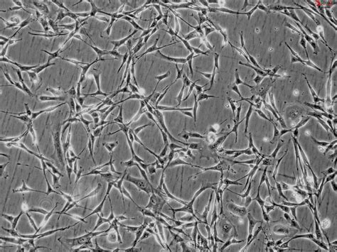 Human Pulmonary Fibroblasts Adult