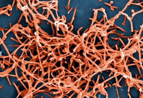 Rapid Accurate Diagnostics For Ebola Niaid National Institute Of Allergy And Infectious Diseases