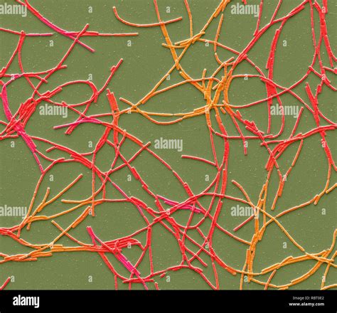 Anthrax Bacteria Coloured Scanning Electron Micrograph SEM Of