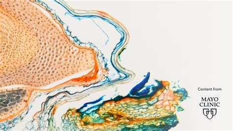 Mayo Clinic Alzheimers And Gut Health Thorne