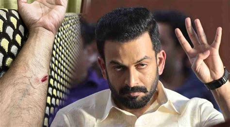 Prithviraj Sukumaran Met With A Minor Accident