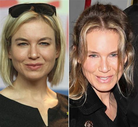 Plastic Surgery Gone Wrong For These 15 Actresses