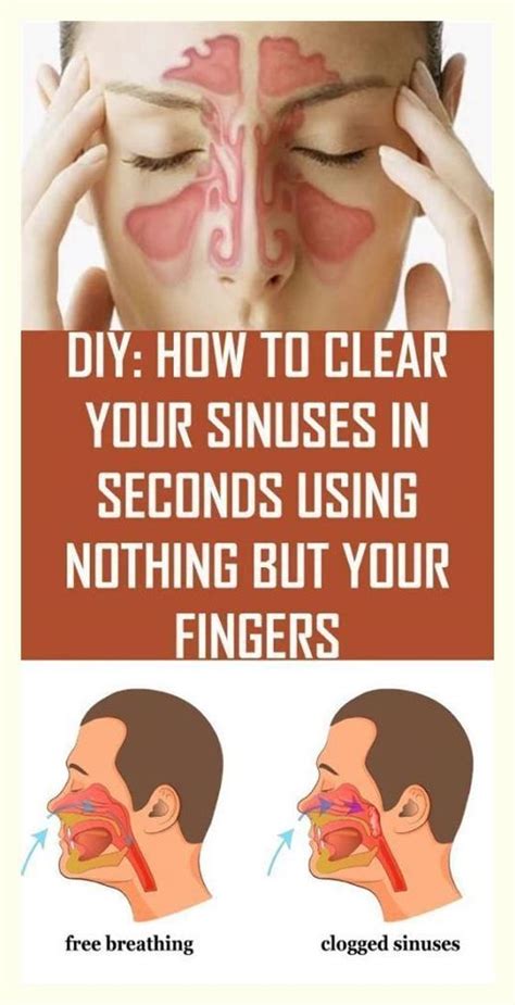 How To Clear Your Sinuses In Seconds Using Nothing But Your Fingers Sinusitis Sinus Blockage