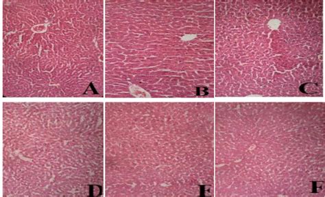 Photomicrographs Showing The Effect Of Silymarin Ccl4 Control Group
