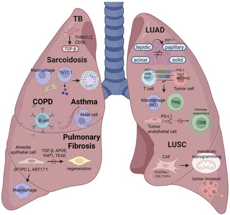 Spatial Transcriptomics In Lung Cancer And Pulmonary Diseases A