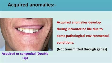 Types Of Developmental Anomalies Pptx