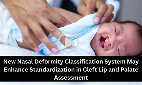 New Nasal Deformity Classification System May Enhance Standardization