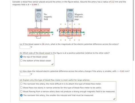 Solved Consider A Blood Flow Sensor Placed Around The Artery Chegg