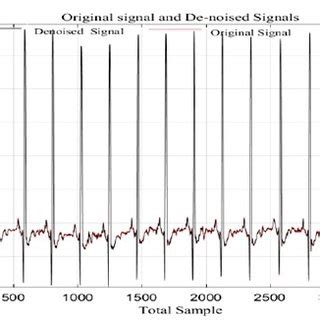 De Noised The ECG Signal Download Scientific Diagram