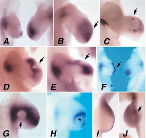 Figure 3 From The Bmp Antagonist Gremlin Regulates Outgrowth