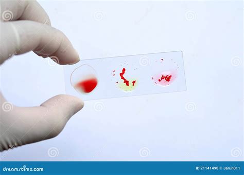Blood Group And Rh Factor Testing Royalty Free Stock Image