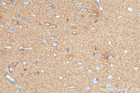Dclk1 Antibody 68234 1 Ig Proteintech