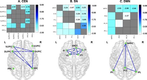 Group Differences Of Functional Connectivity Igd Individuals Showed Download Scientific