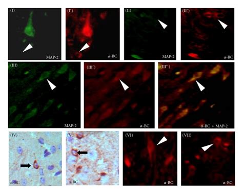 Induction Of Map 2 In Green Fluorescence And αb Crystallin α Bc In