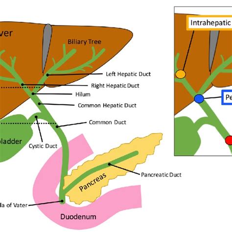 Pdf Recent Advances In Understanding Cholangiocarcinoma