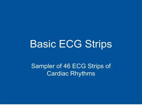 Ppt Basic Ecg Powerpoint Presentation Free Download Id4748985