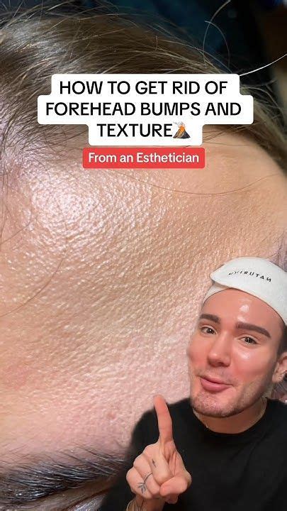 HOW TO GET RID OF SKIN TEXTURE Follow For More Skincare Skin Skincareroutine Acne