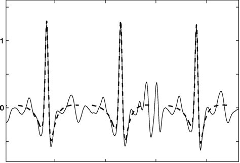 Rational Approximation Of Qrs Complexes The Dashed Curves Are Graphs