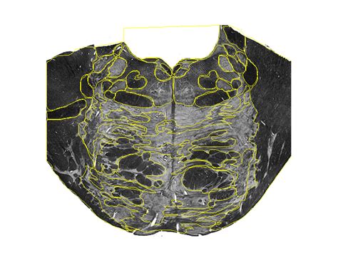 Pons Trigeminal Motor Nucleus Quiz