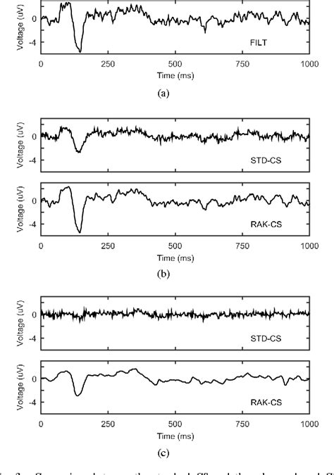 figure 3 from low power eeg monitor based on compressed sensing with