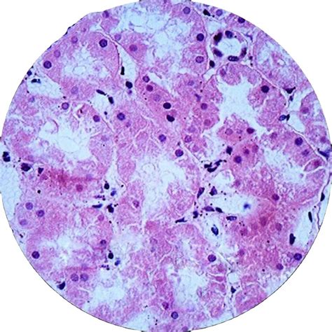 Fixed Set 50 Kinds Human Pathology Microscope 100 Pcs Medical Parasitology Prepared Slide Set