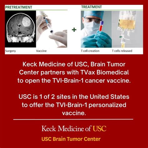 Usc Brain Tumor Center On Linkedin Brain Braintumor Braincancer