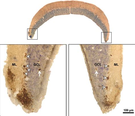Presence Of Very Small Turtle Calbindin Immunoreactive Cells At The Download Scientific Diagram