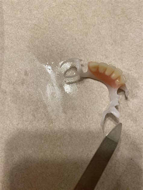 Fix Rdentures