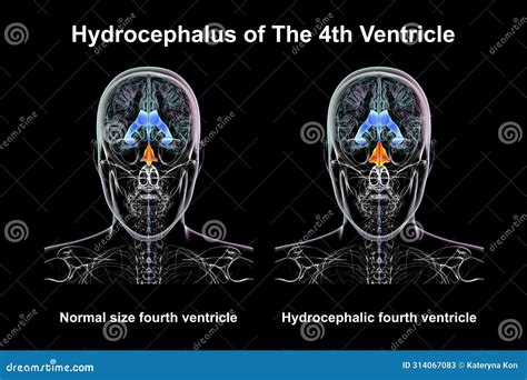 The Fourth Brain Ventricle 3d Illustration Royalty Free Cartoon