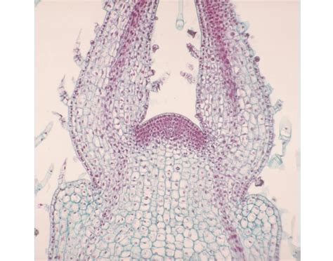 Coleus Stem Tip Section Quiz