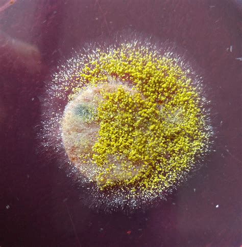 Aspergillus Flavus Mold Xperts