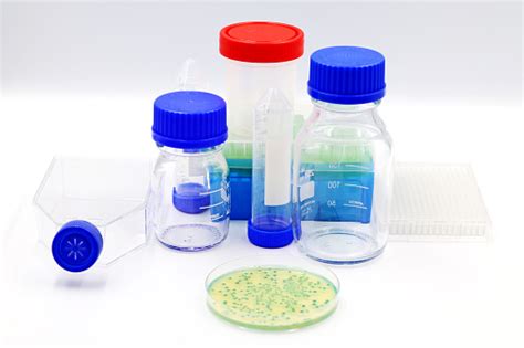 실험실 재료와 함께 박테리아 Escherichia Coli의 식민지가 들어있는 페트리 접시 0명에 대한 스톡 사진 및 기타 이미지 0명 건강 검진 건강관리와 의술
