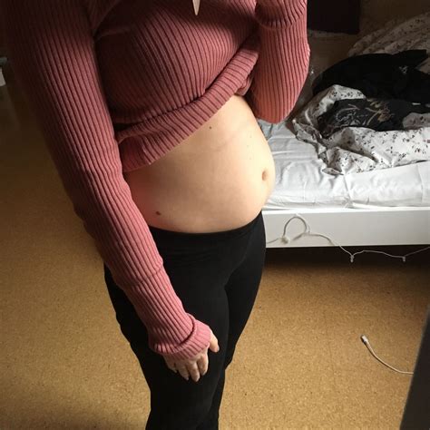 Dicker Bauch Und Leichte Verstopfung Seit 4 Wochen Was Kann Das Sein