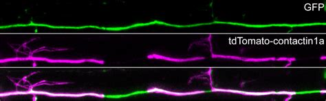 Rafael Almeida Centre For Discovery Brain Sciences Centre For Discovery Brain Sciences