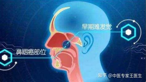 鼻咽癌中医治疗方法有哪些 知乎