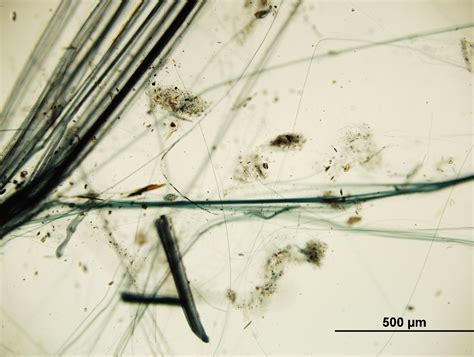 7 Essential Steps To Ensure Best Results From Your Polarized Light Microscope Plm