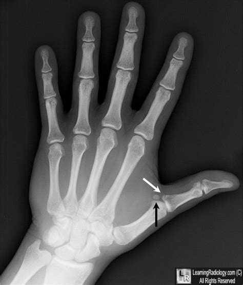 إصـابـة Injury On Twitter 🚨 إصابة ادوارد ميندي أعلن النادي عن