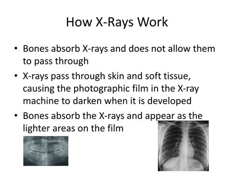 PPT 17 2 Waves Of The Electromagnetic Spectrum PowerPoint Presentation ID 1701749