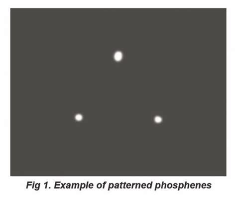 Introduction To Visual Prostheses By Eduardo Fernandez And Richard Normann Webvision