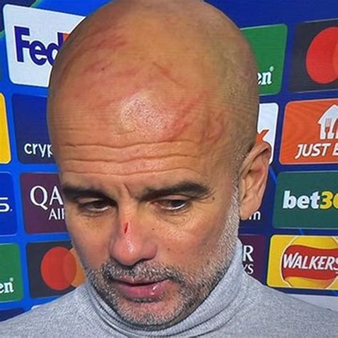 Video Pep Guardiola No Contuvo Su Ira Por El Empate Del City ¡y Se