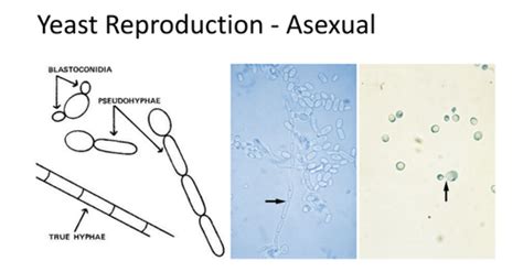 Mycology Yeast And Yeast Like Fungi Flashcards Quizlet