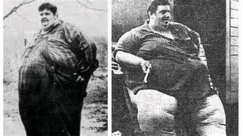Jon Brower Minnochs Historic Weight Loss Before And After