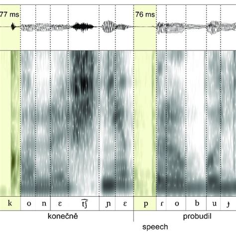 Segmentation Of Word Initial Plosives Their Duration Is Annotated Download Scientific Diagram