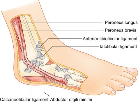 Anterior Talofibular Ligament Injection Clinical Tree