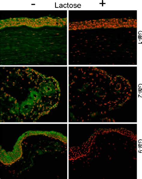 Lectin Histochemical Localization Of Tissue Reactivity For Galectins 1
