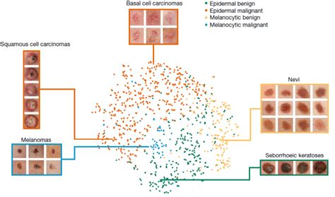 Lintelligence Artificielle En Contexte Médical